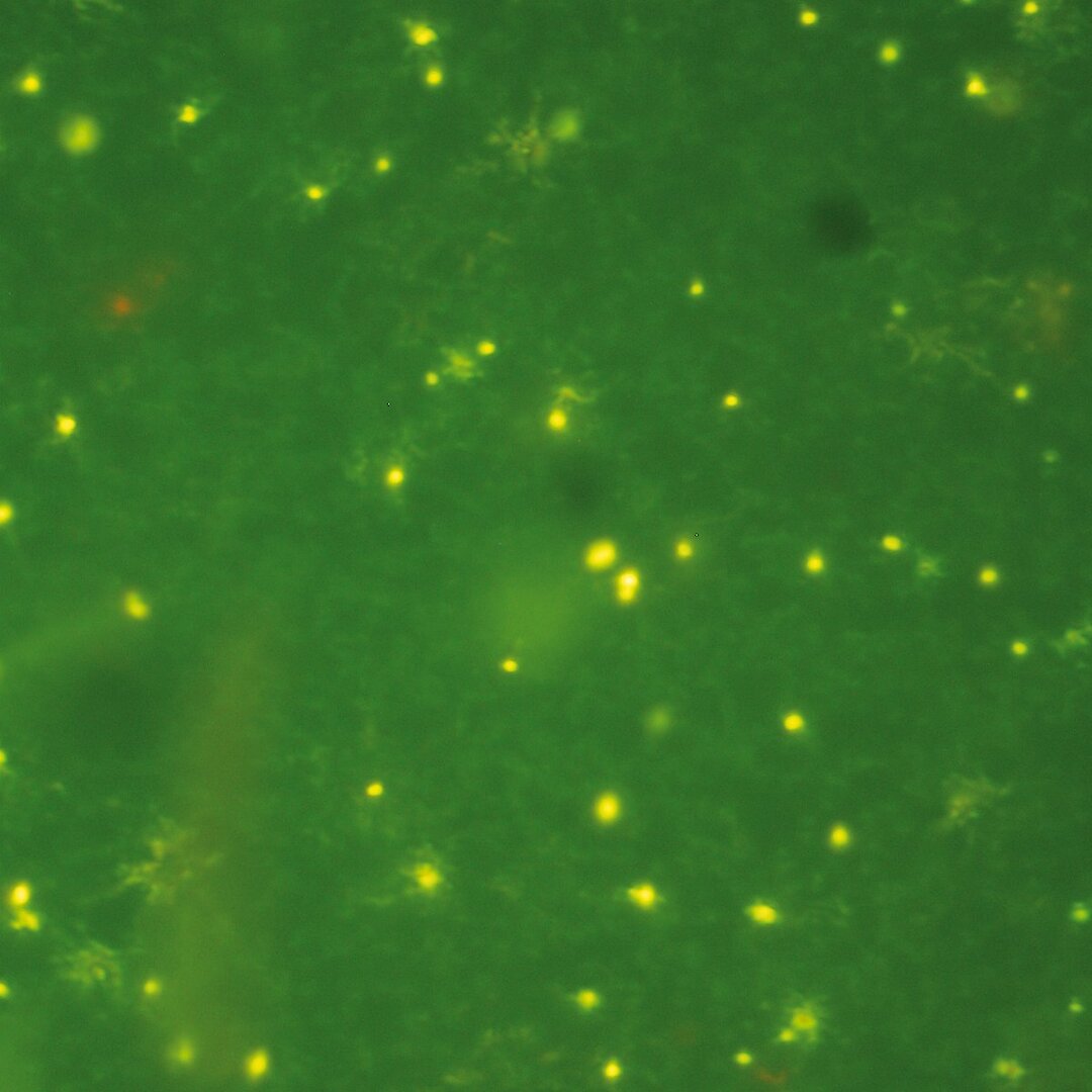 Capturing the ocean’s microbial diversity — Australian Antarctic ...