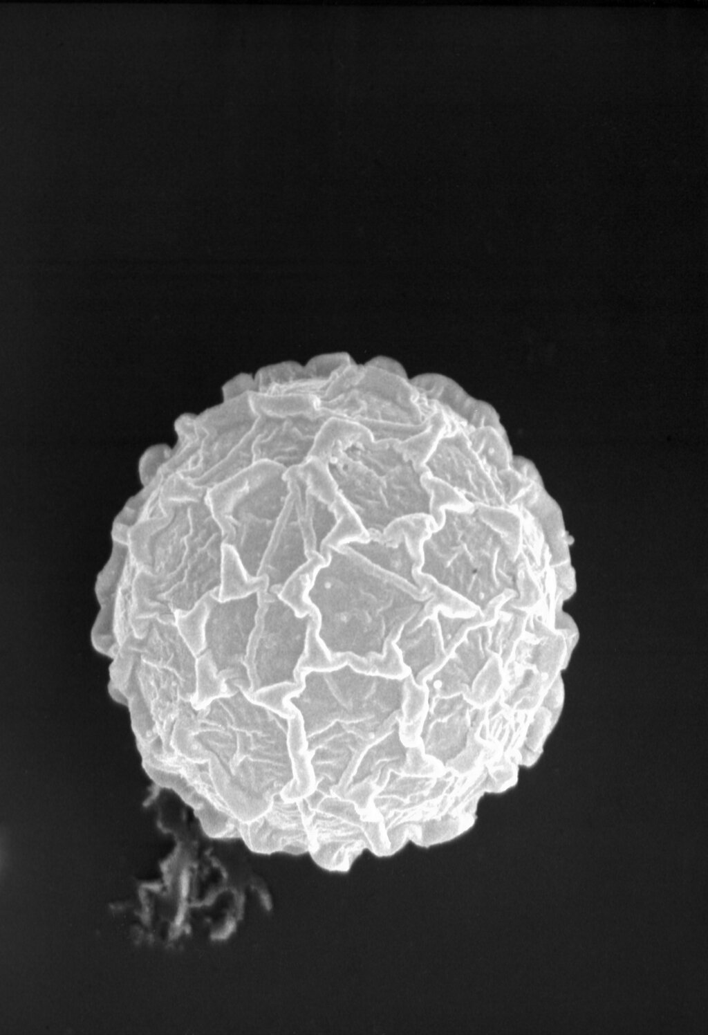 Snow algae — Australian Antarctic Program